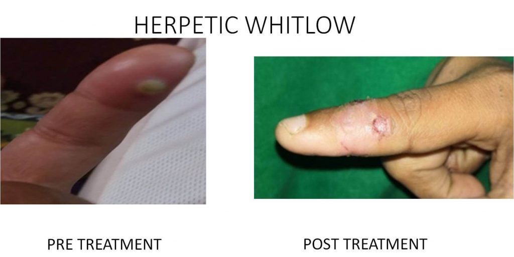 Oral Medicine & Radiology – RD Dental College