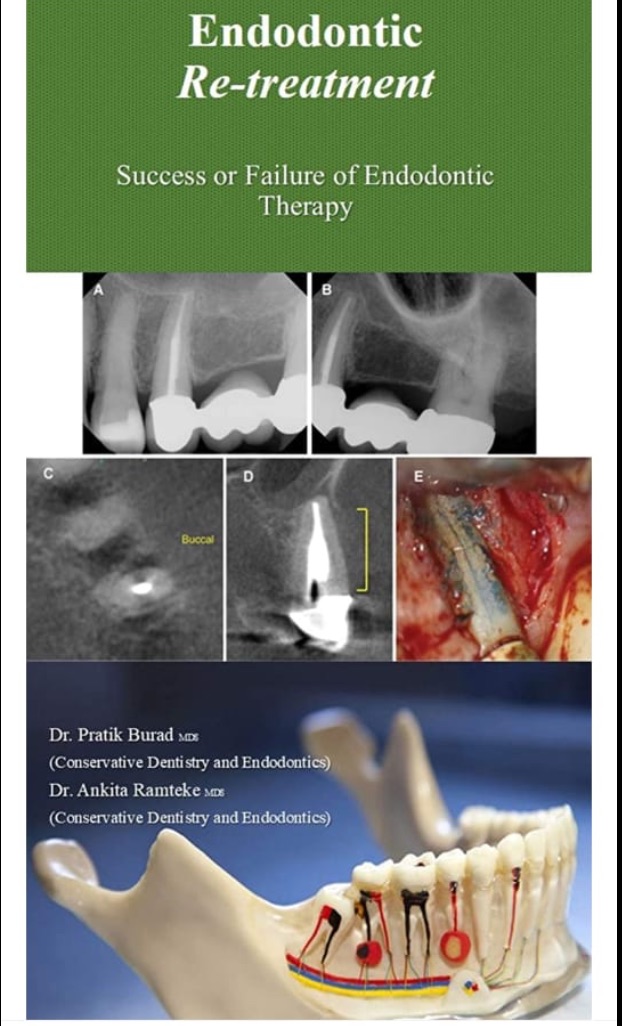 Dr. Pratik Burad has Authored a Book titled: “Endodontic Retreatment ...